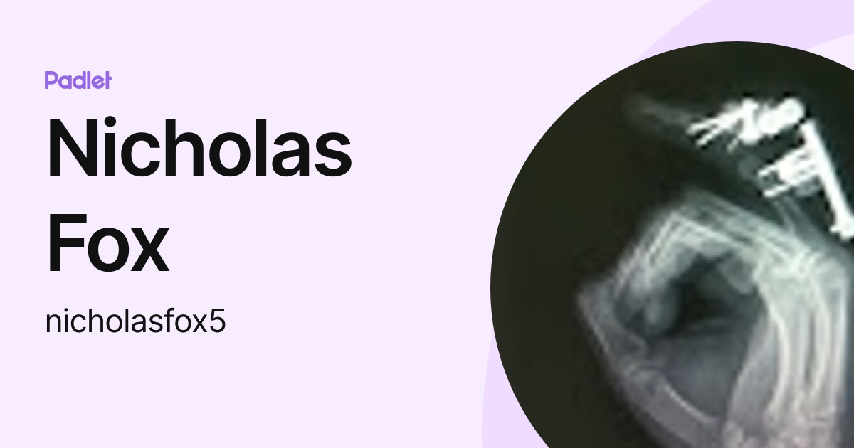 Nicholas Fox (nicholasfox2) profile | Padlet